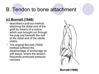 flexor TENDON GRAFTING one and two stage.ppt
