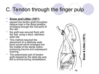flexor TENDON GRAFTING one and two stage.ppt