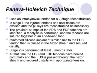 flexor TENDON GRAFTING one and two stage.ppt