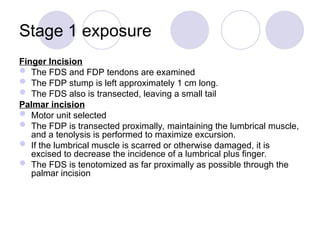 flexor TENDON GRAFTING one and two stage.ppt