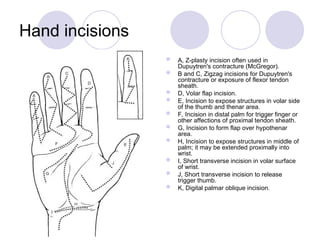 flexor TENDON GRAFTING one and two stage.ppt