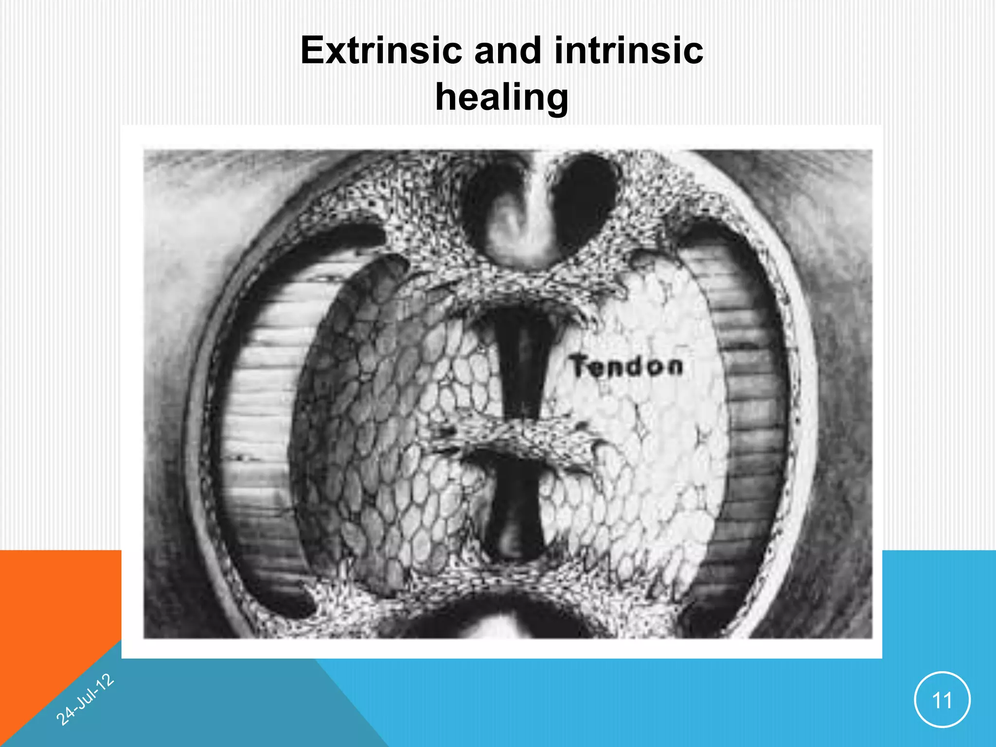 Tendon healing | PPTX