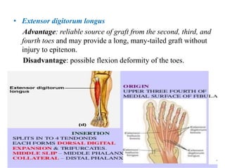 Tendon healing and tendon grafting | PPTX