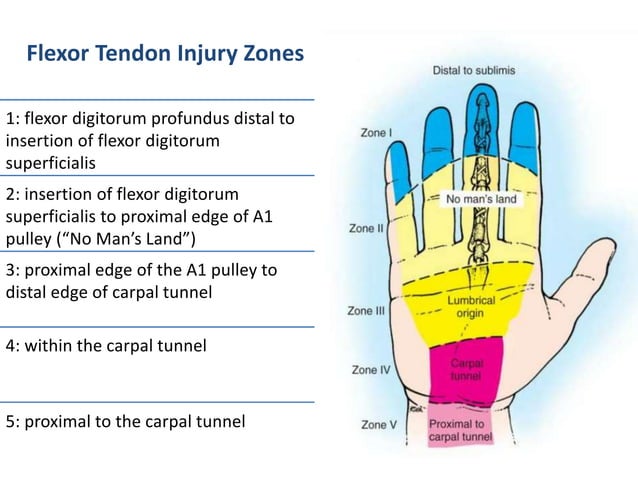 Tendon injuries of hand | PPT