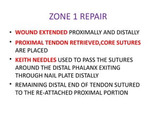 Tendon injuries of hand | PPTX