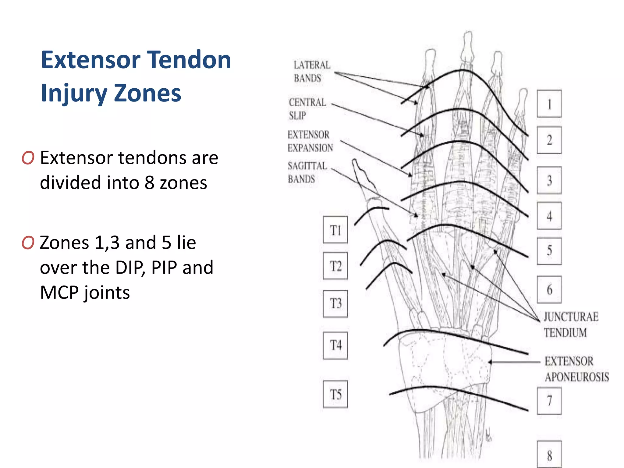 Tendon injuries of hand by Dr Saumya Agarwal | PPTX