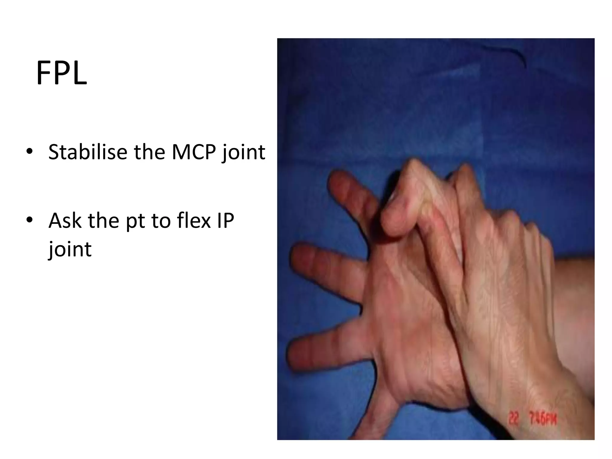 Tendon injuries of hand by Dr Saumya Agarwal | PPTX