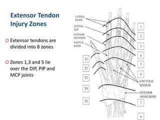Tendon injuries of hand by Dr Saumya Agarwal | PPTX