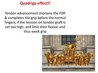 Tendon injuries of hand by Dr Saumya Agarwal | PPTX