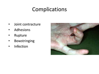 Tendon injuries of hand by Dr Saumya Agarwal | PPTX
