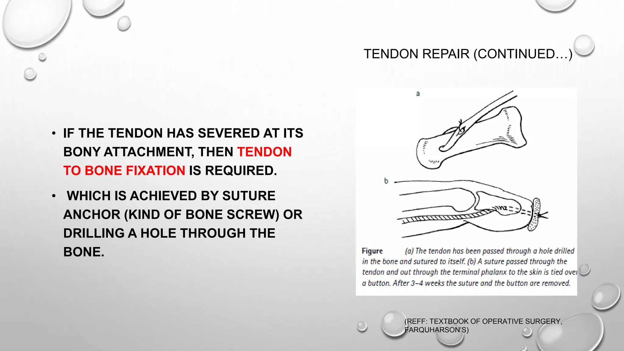 Tendon injury and repair | PPTX