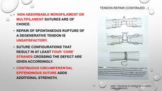 Tendon injury and repair | PPTX