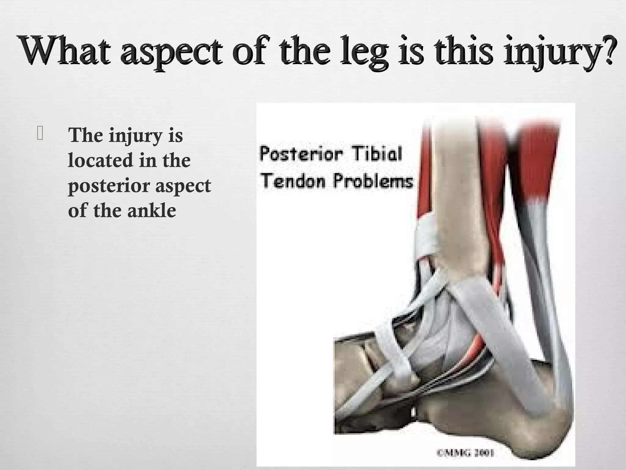 Ankle Tendonitis | PPT