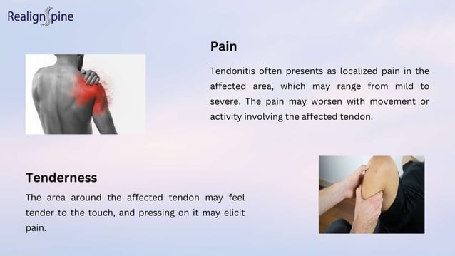 Tendonitis Symptoms And Causes | PPT