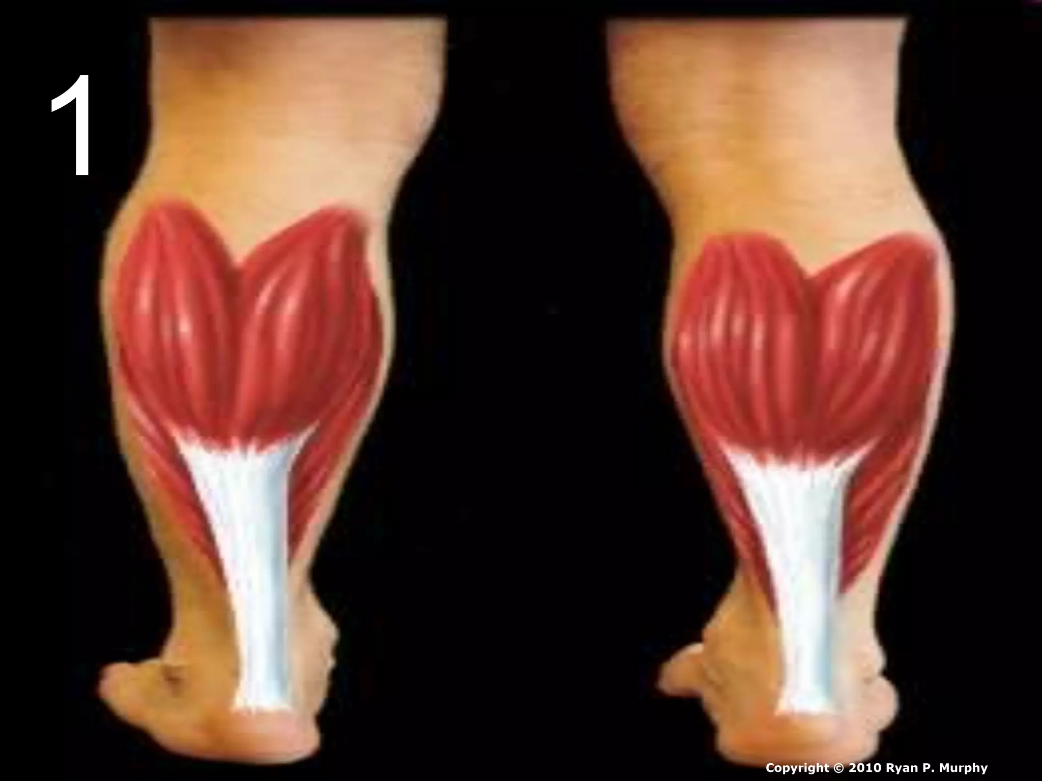 Tendon or Ligament Quiz, Build a Arm with Popsicle Sticks Lesson | PPT