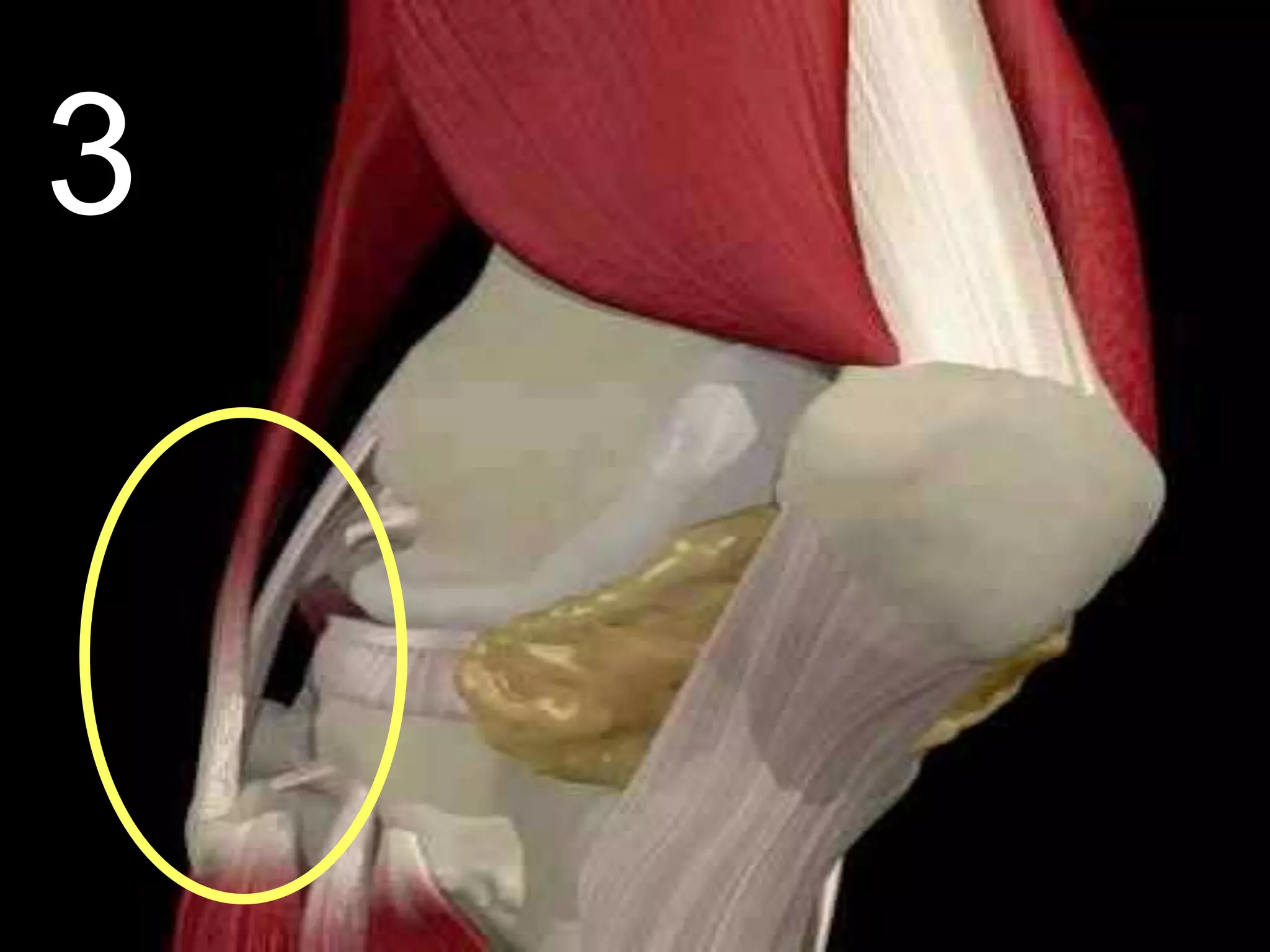 Tendon or Ligament Quiz, Build a Arm with Popsicle Sticks Lesson | PPT