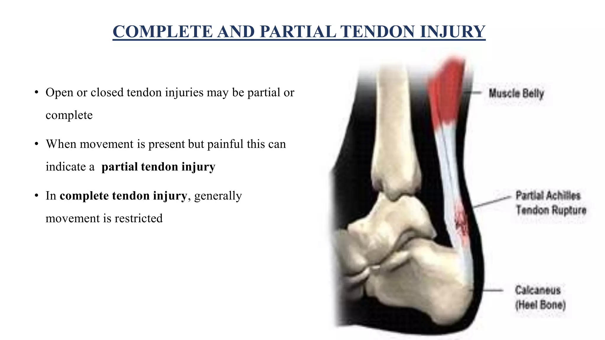 Tendon repair | PPTX | Death, Injury, or Military Conflict | Sensitive ...
