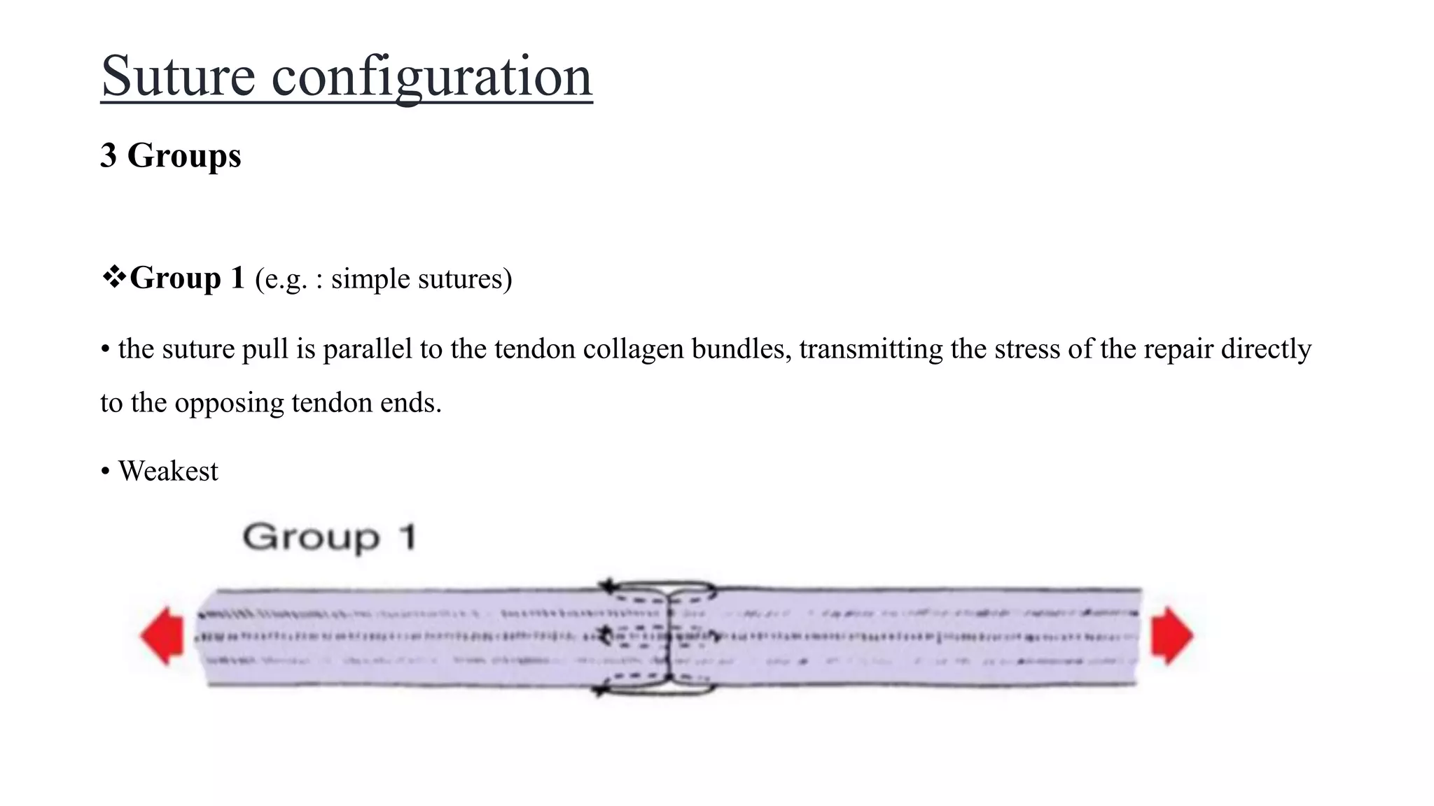 Tendon repair | PPTX