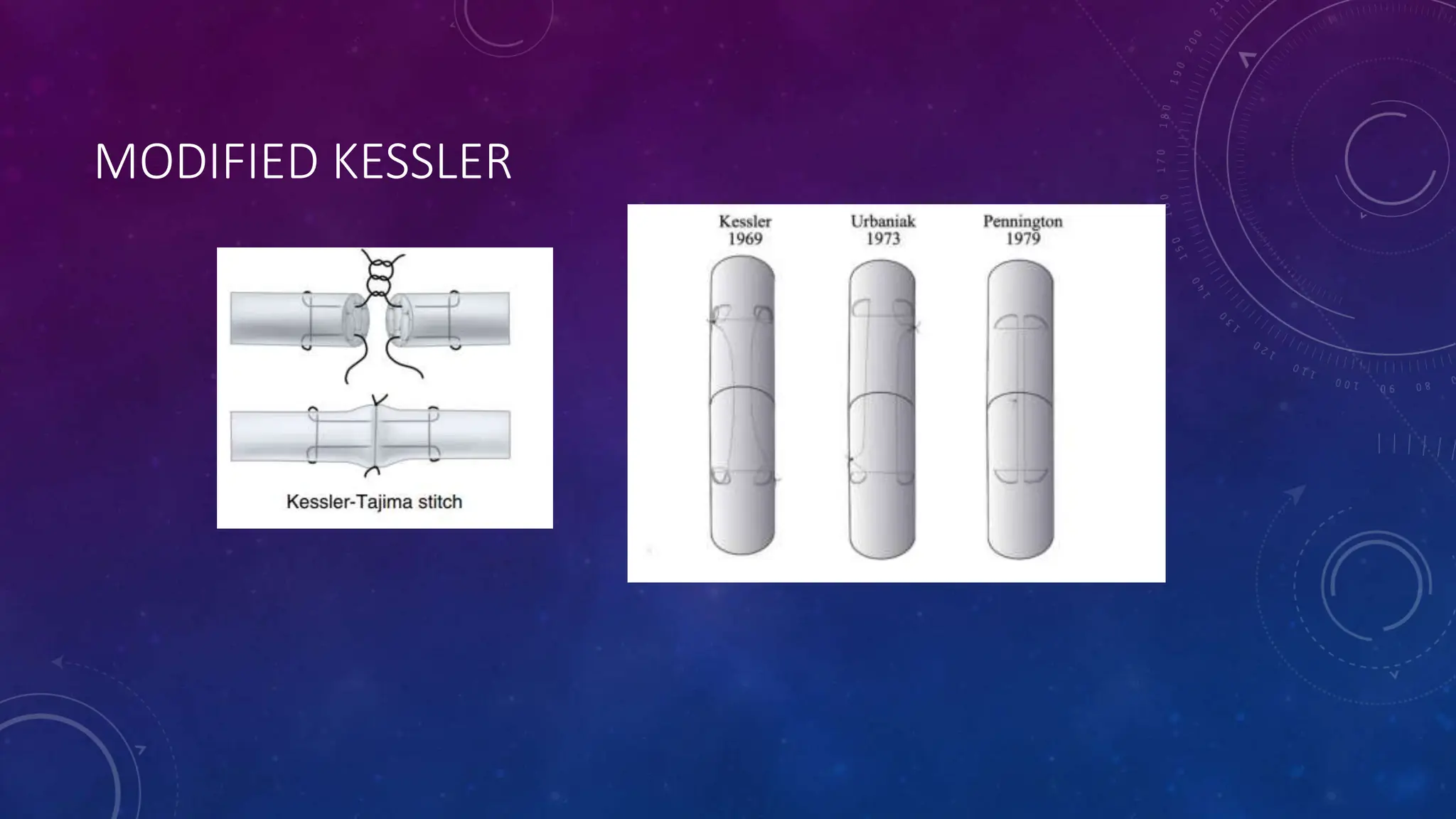 TENDON REPAIR – PRINCIPLES ^0 TYPES-1.pptx