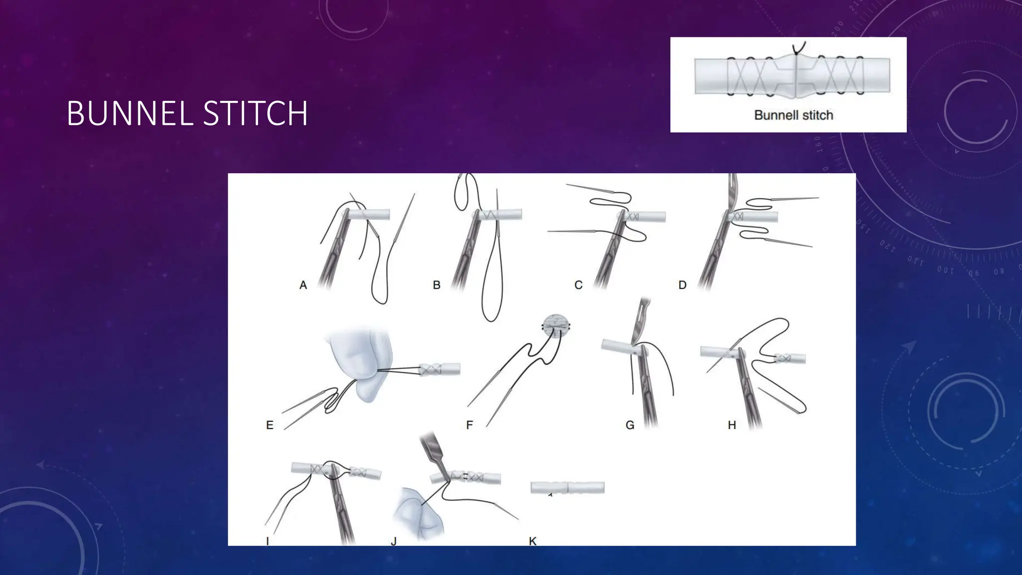 TENDON REPAIR – PRINCIPLES ^0 TYPES-1.pptx