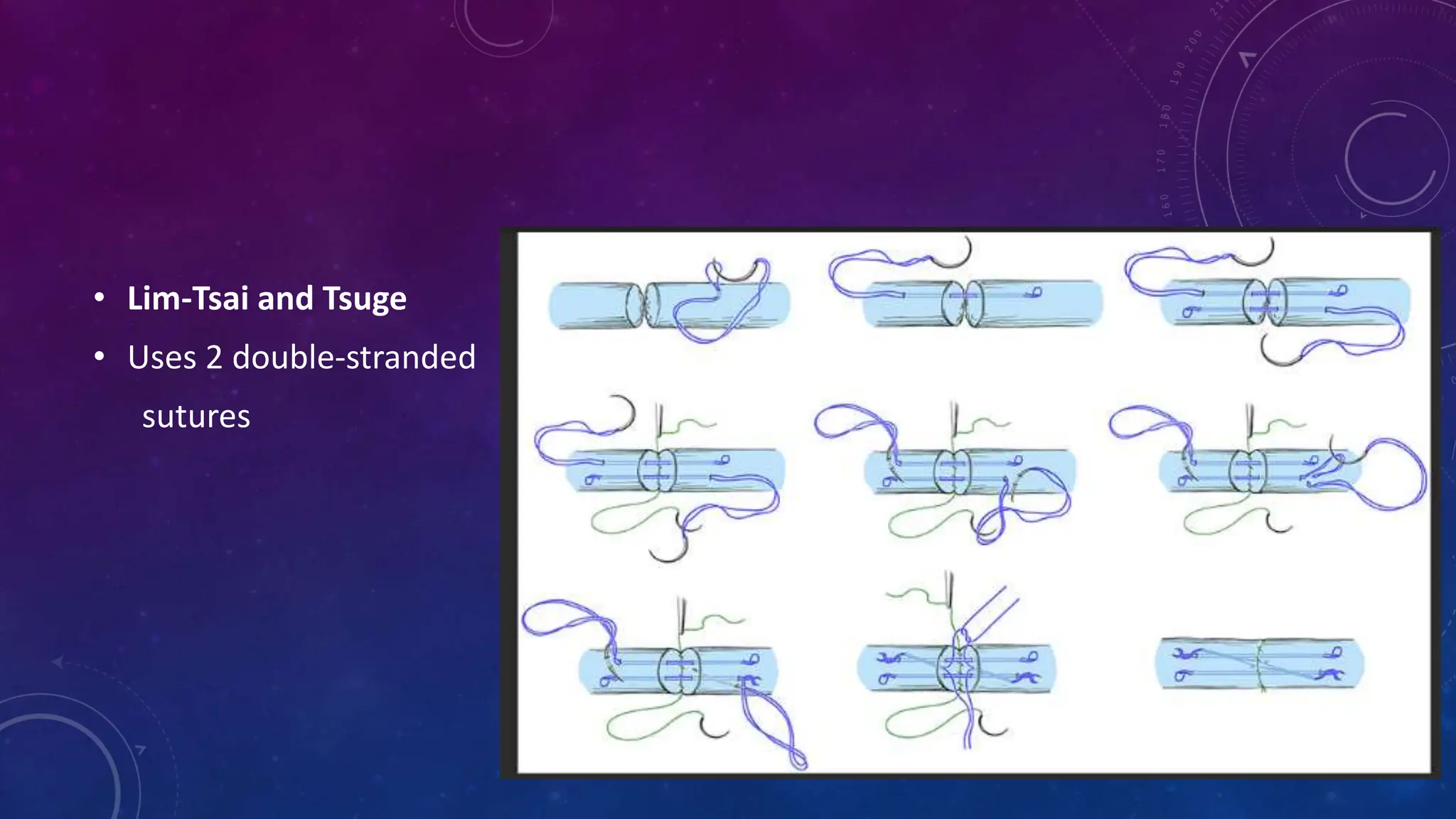TENDON REPAIR – PRINCIPLES ^0 TYPES-1.pptx