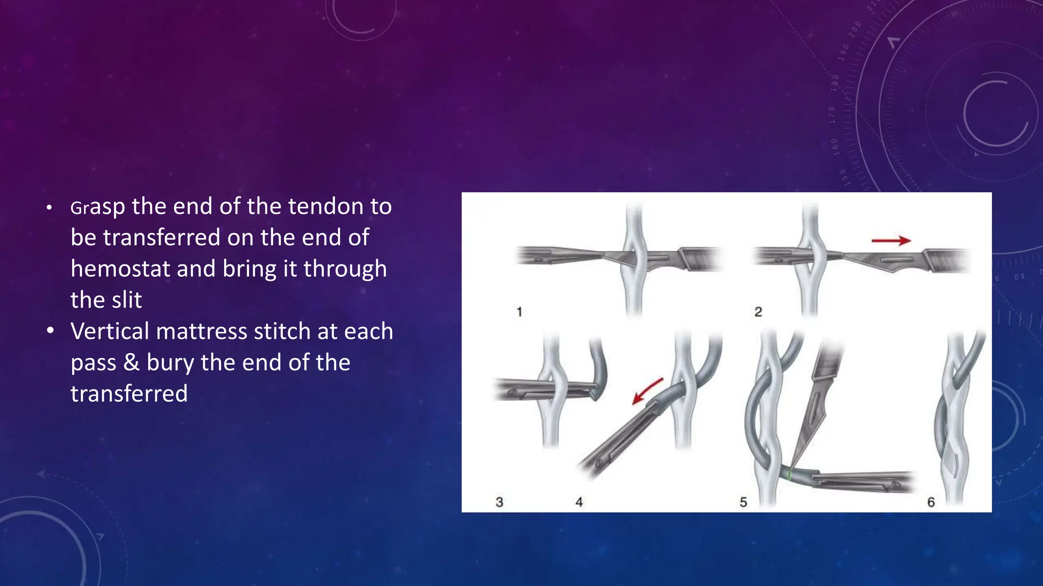 TENDON REPAIR – PRINCIPLES ^0 TYPES-1.pptx