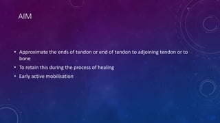 TENDON REPAIR – PRINCIPLES ^0 TYPES-1.pptx