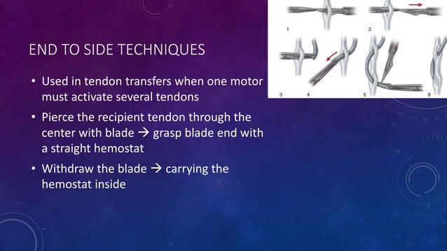 TENDON REPAIR – PRINCIPLES ^0 TYPES-1.pptx
