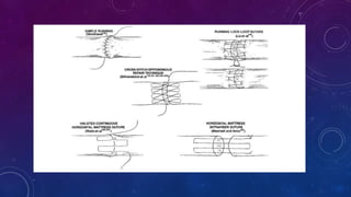 TENDON REPAIR – PRINCIPLES ^0 TYPES-1.pptx