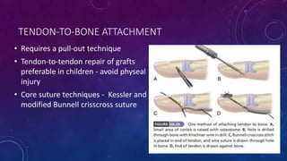 TENDON REPAIR – PRINCIPLES ^0 TYPES-1.pptx