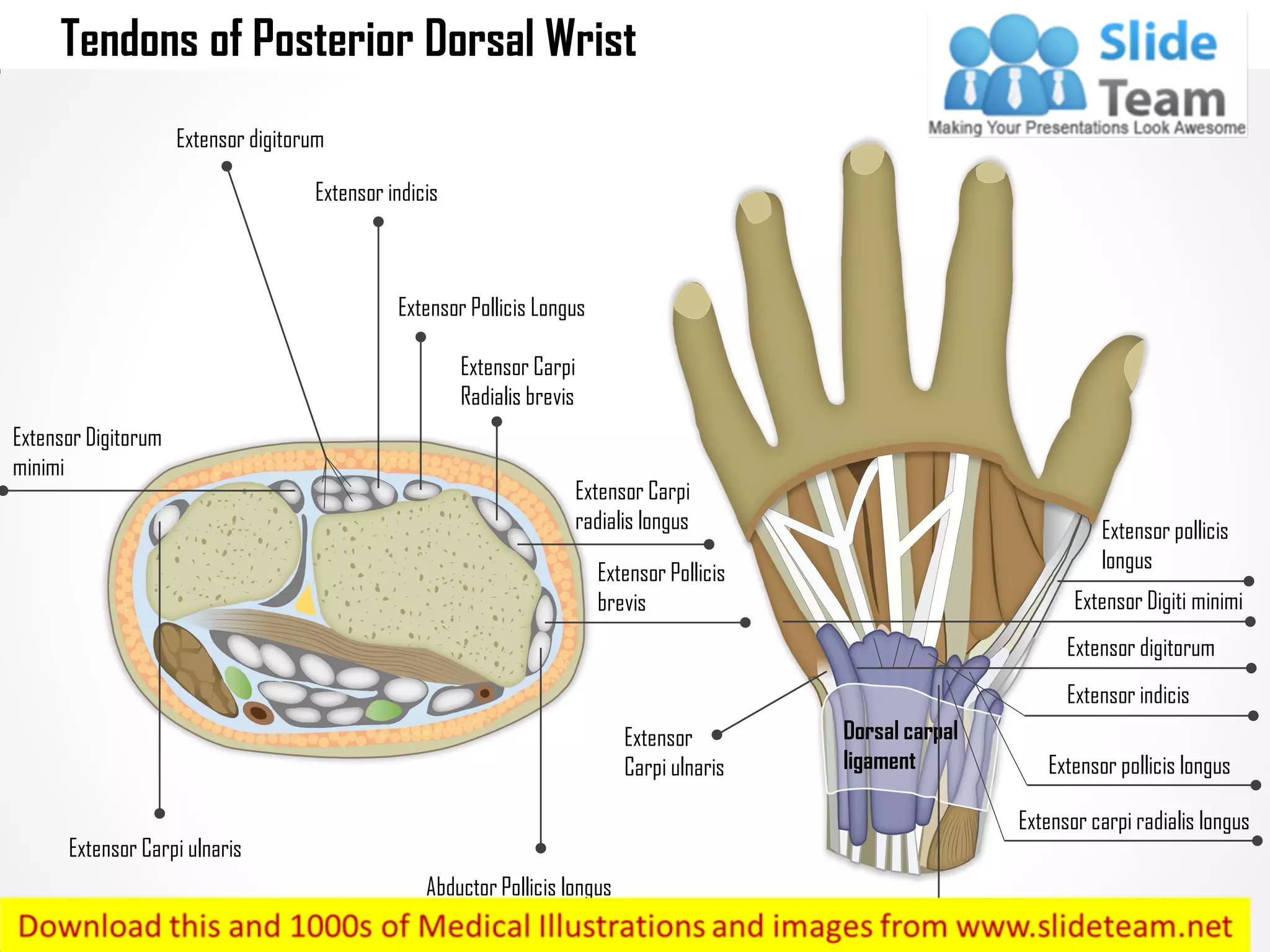 Tendons of the posterior (dorsal) wrist medical images for power point ...