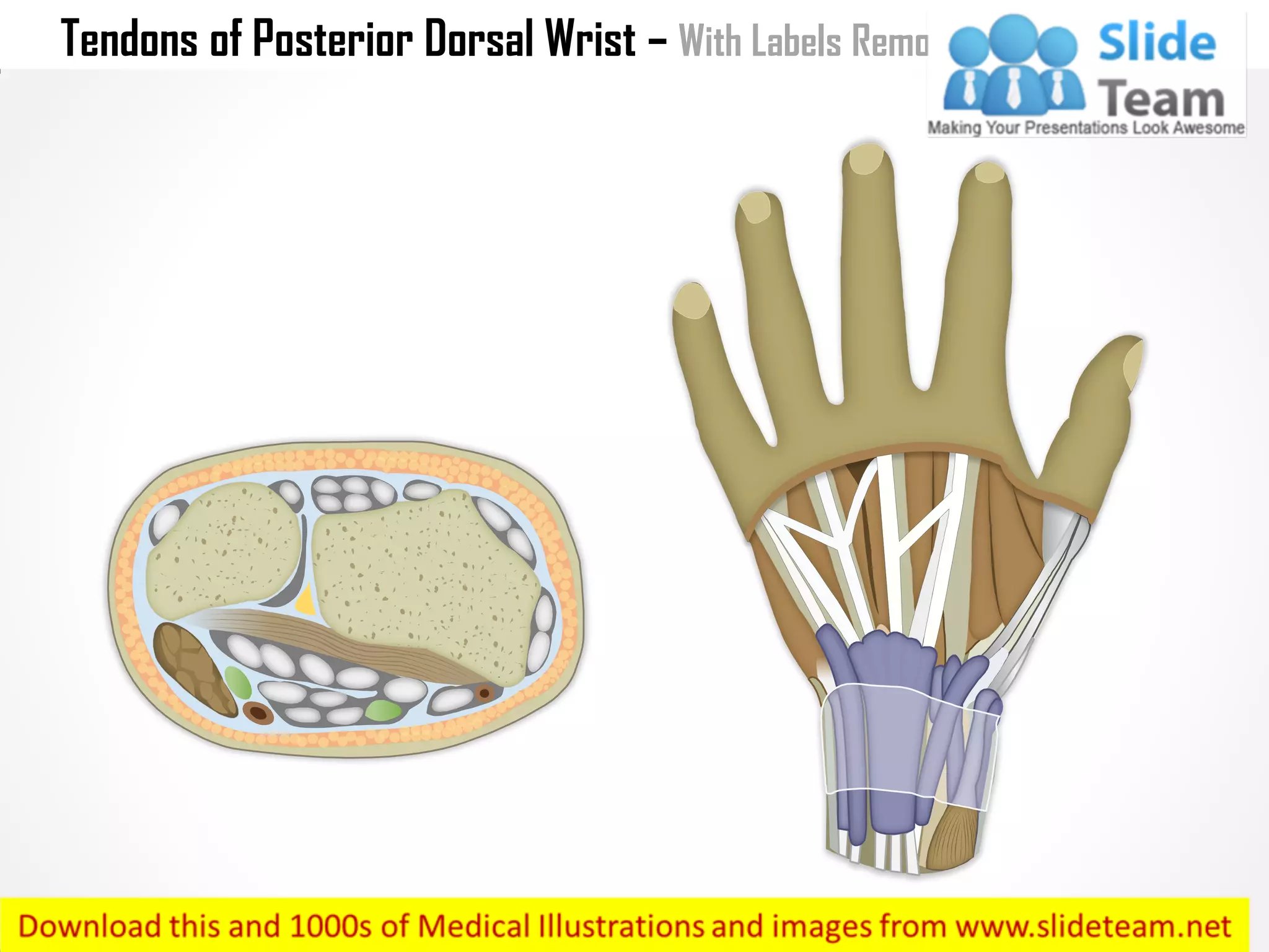 Tendons of the posterior (dorsal) wrist medical images for power point ...