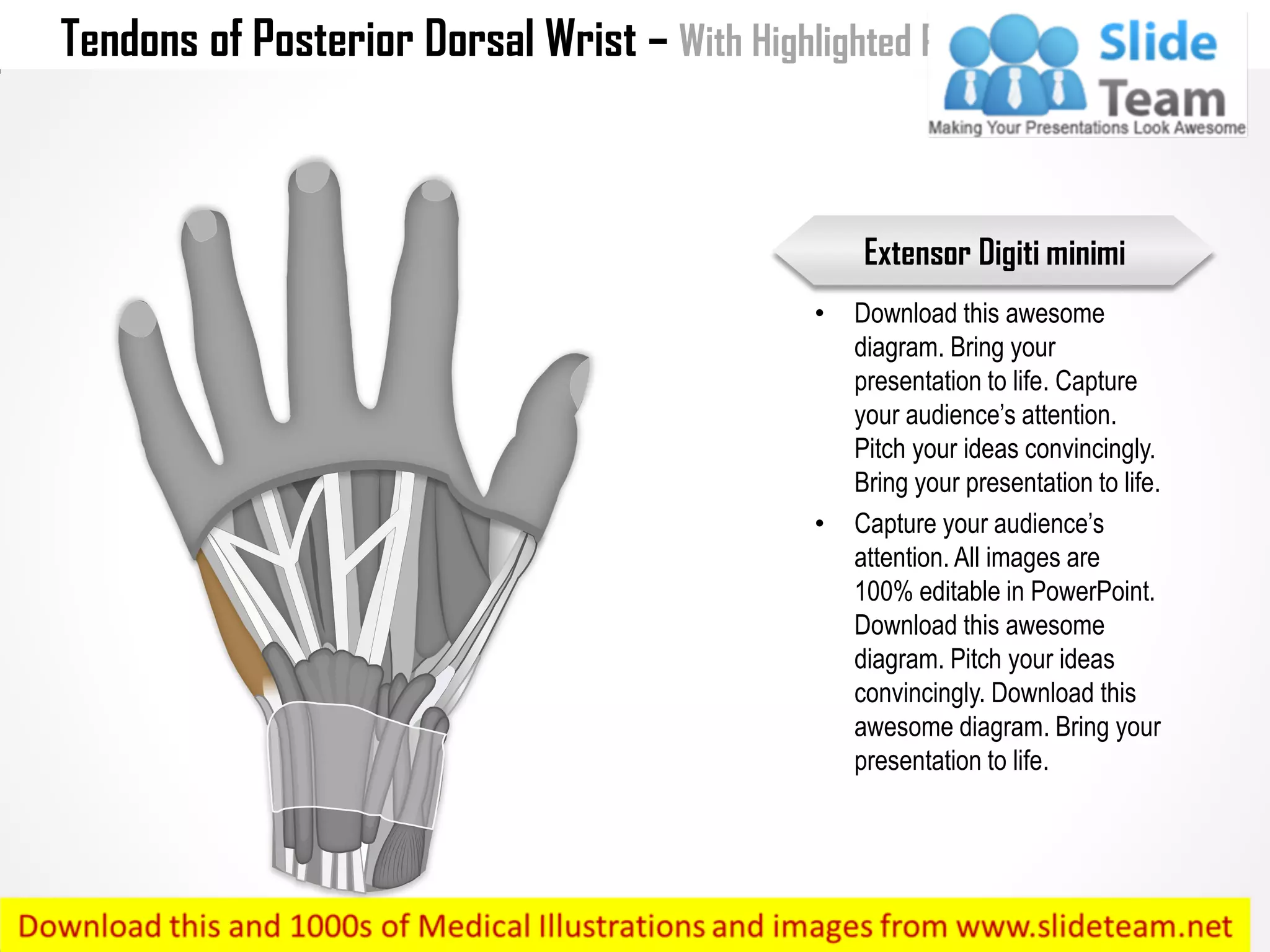 Tendons of the posterior (dorsal) wrist medical images for power point ...