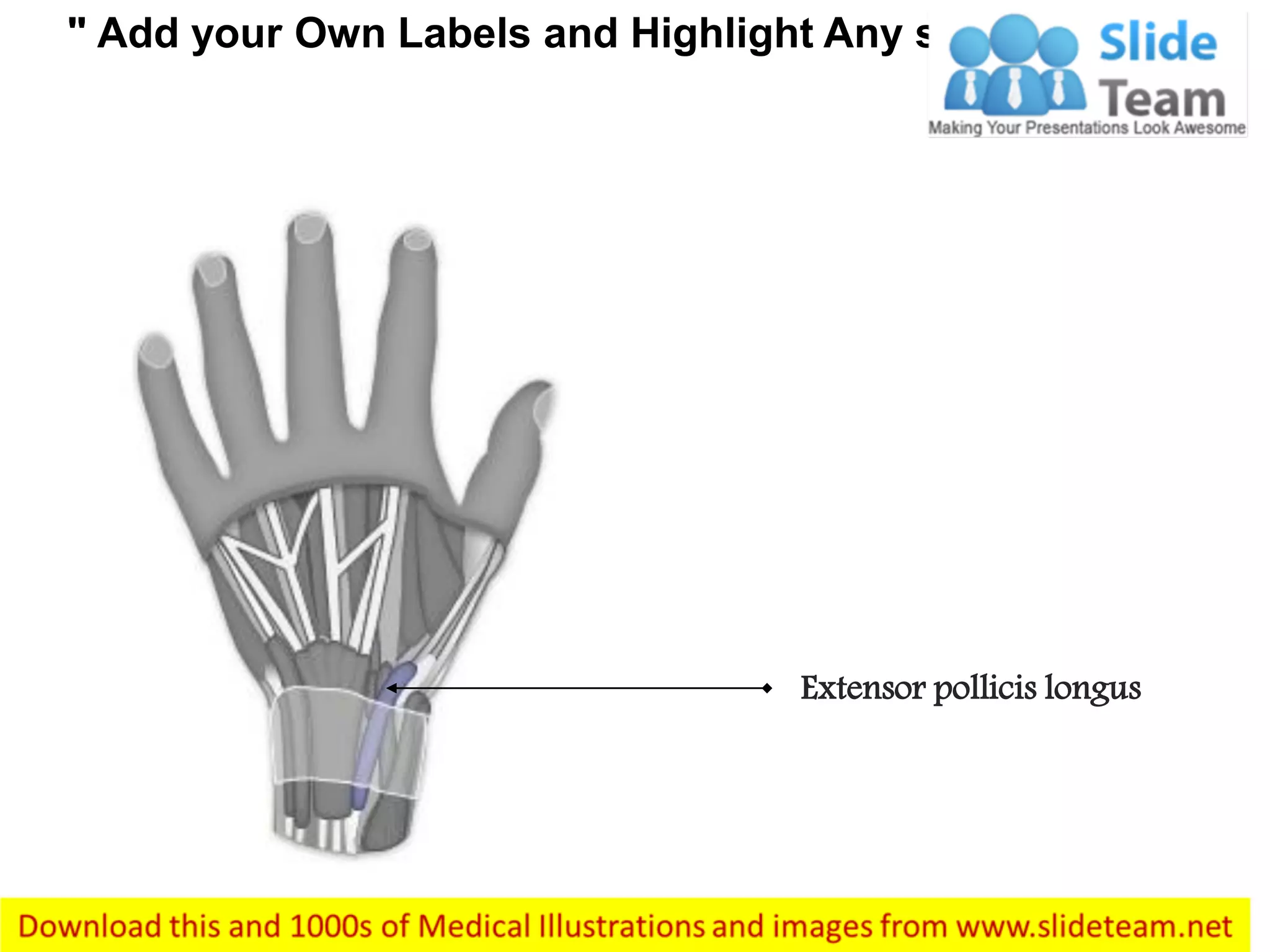 Tendons of the posterior (dorsal) wrist medical images for power point ...