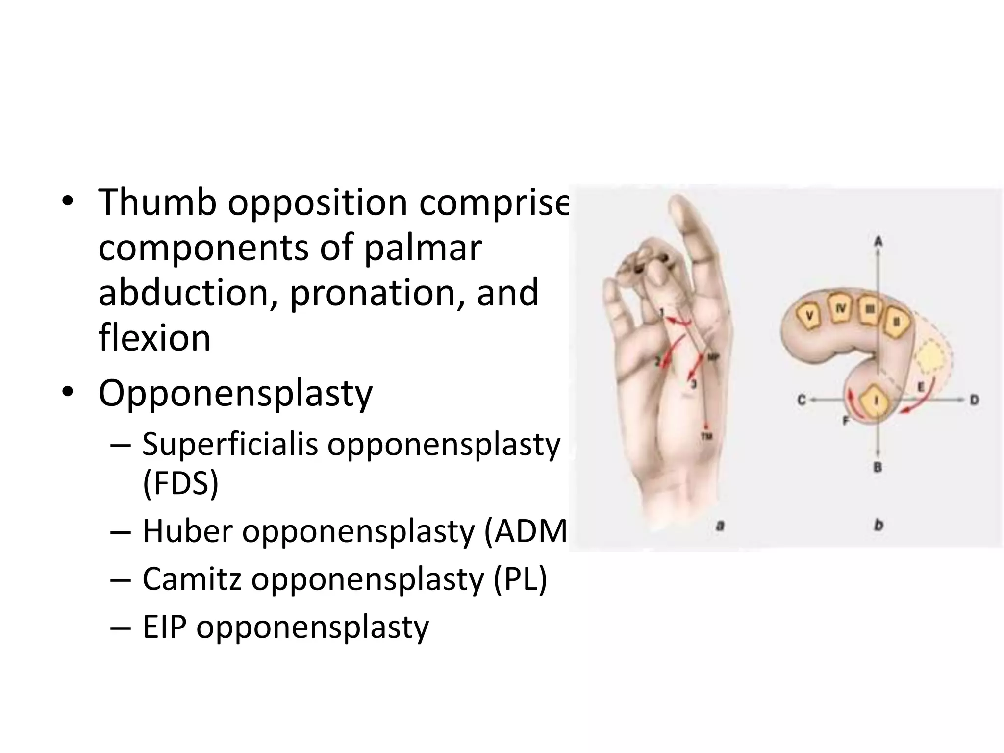 Tendon transfer- principles and techniques | PPTX