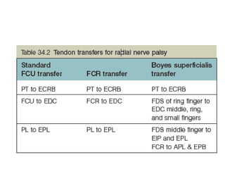 Tendon transfer- principles and techniques | PPTX
