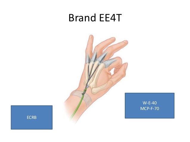 Tendon transfer- principles and techniques