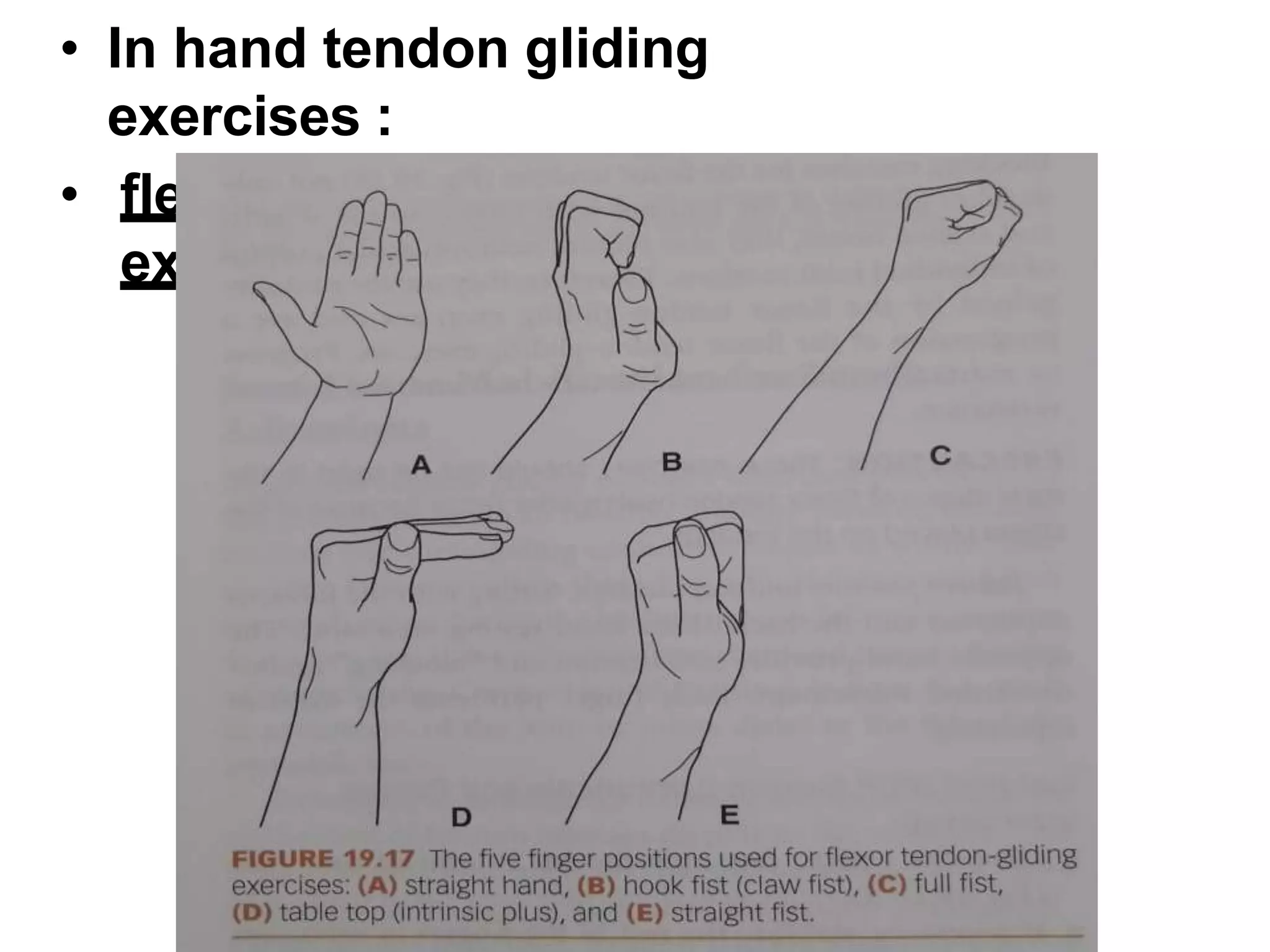 TENDON TRANSFER-WPS Office_WPS PDF convert-converted.pptx