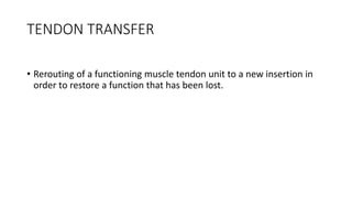 Tendon transfer for Radial nerve Palsy 2 NEW.pptx
