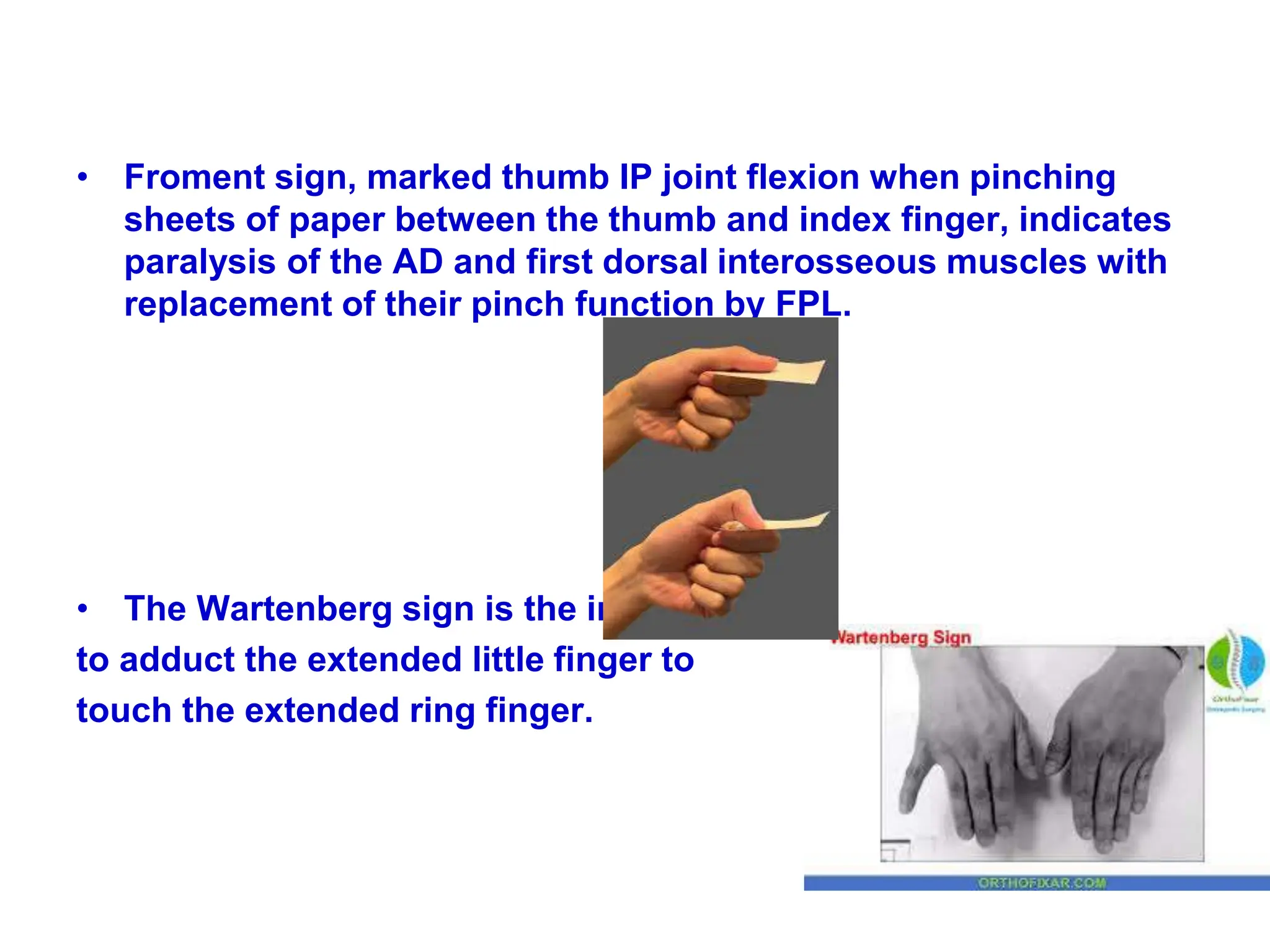 TENDON TRANSFER FOR ULNAR NERVE PALSY ppt | PPTX