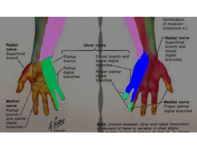 TENDON TRANSFER FOR ULNAR NERVE PALSY ppt | PPTX
