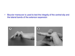 TENDON TRANSFER FOR ULNAR NERVE PALSY ppt | PPTX