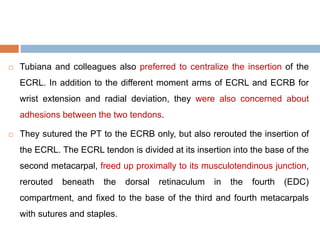 Tendon transfers for radial nerve palsy | PPT