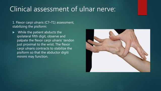 ULNAR NERVE PALSY AND TENDON TRANSFERS | PPT