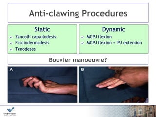 Tendon transfers in hand | PPTX