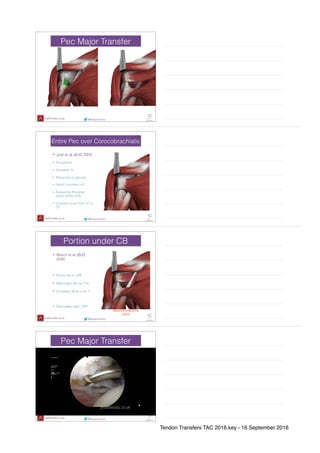 Tendon Transfers around the Shoulder | PDF