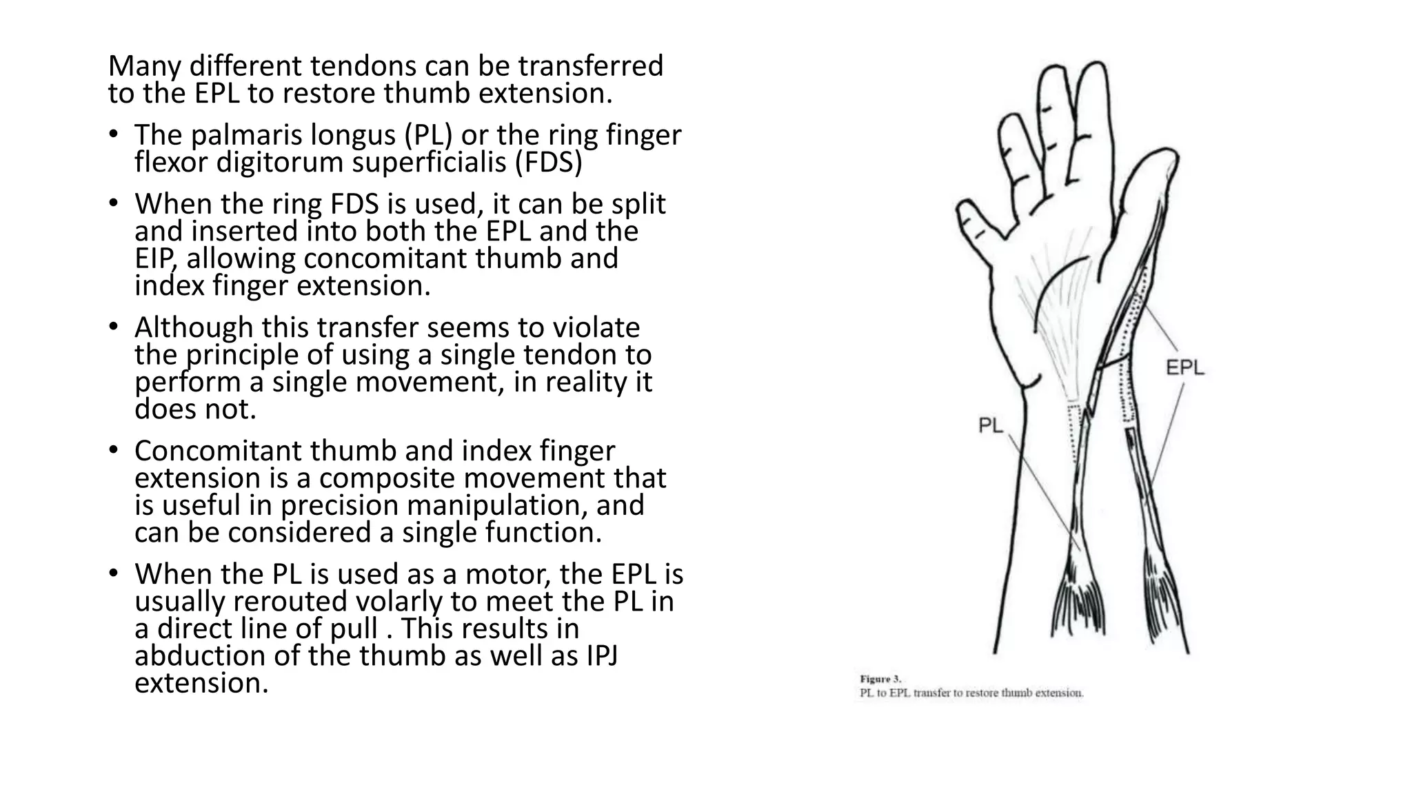 Principles of Transfer and Transfers for Radial Nerve Palsy | PPTX