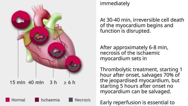 Tenecteplase: Superior Thrombolytic.pptx