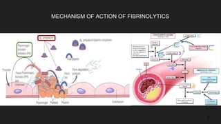 Tenecteplase : A better tPA for Acute ischemic stroke? | PPT