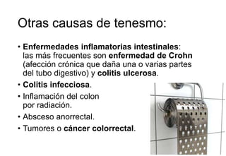 Tenesmo, cuando defecar duele | PPTX